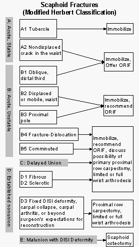 Scaphoid Fracture Classification